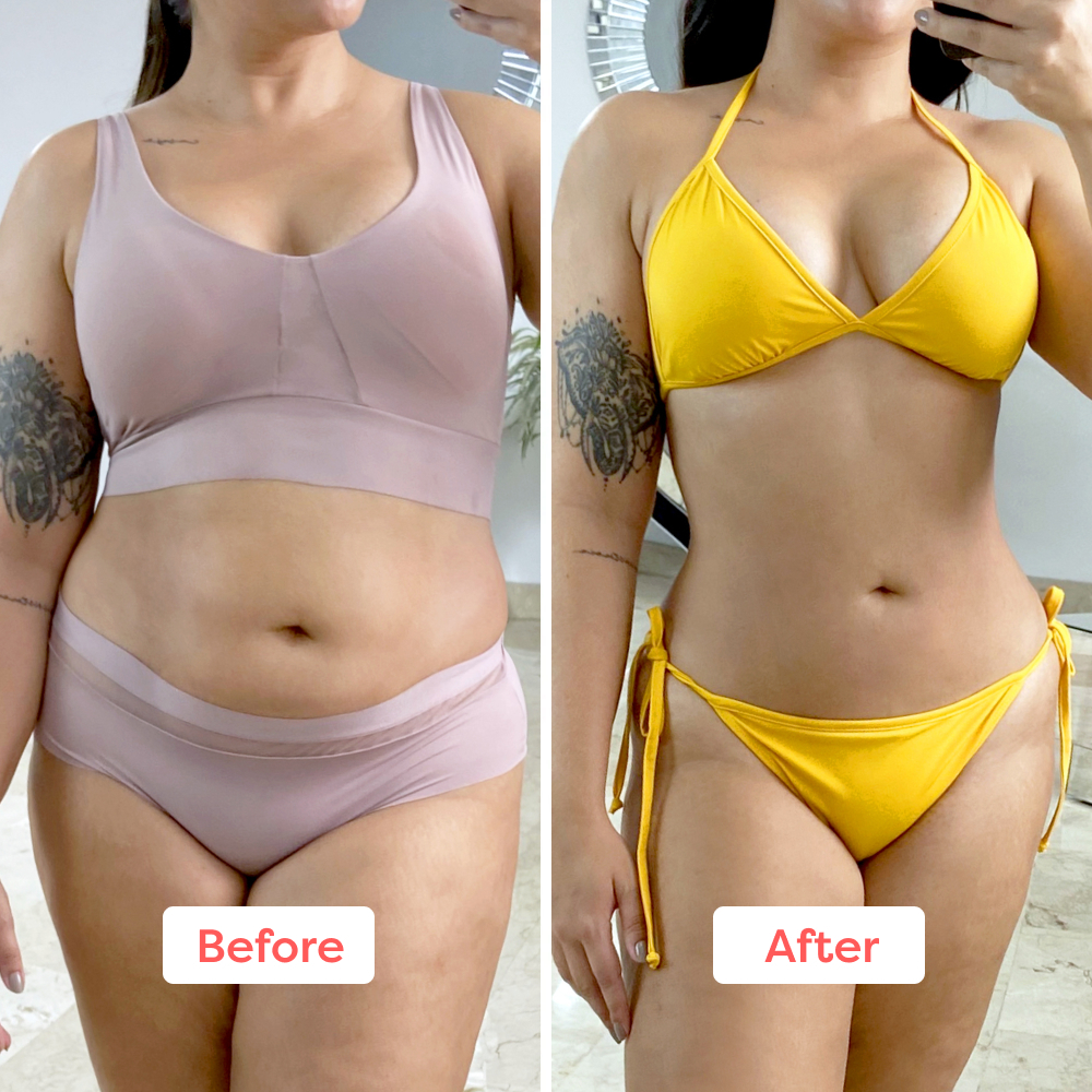 3-in-1 Body Sculptor | Redu Sculpt